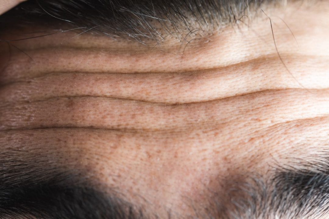 Muttermale Bedeutung Und Ihre Astro Geheimnisse